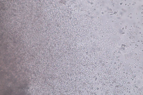 Rain drops Stock Photo by ©tendo23 62818521