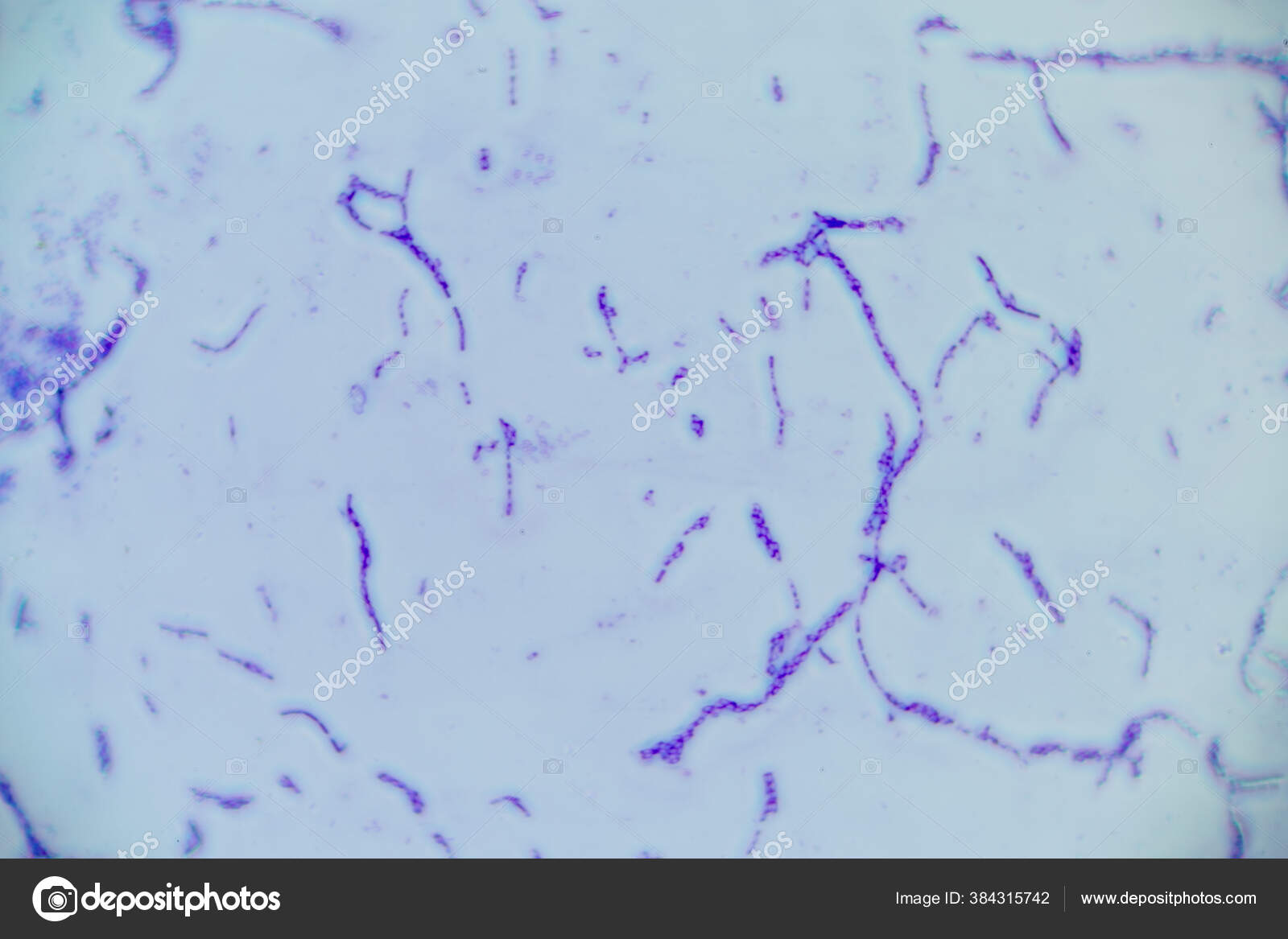 Bacillus Genus Gram Positive Rod Shaped Bacteria Member Phylum ...