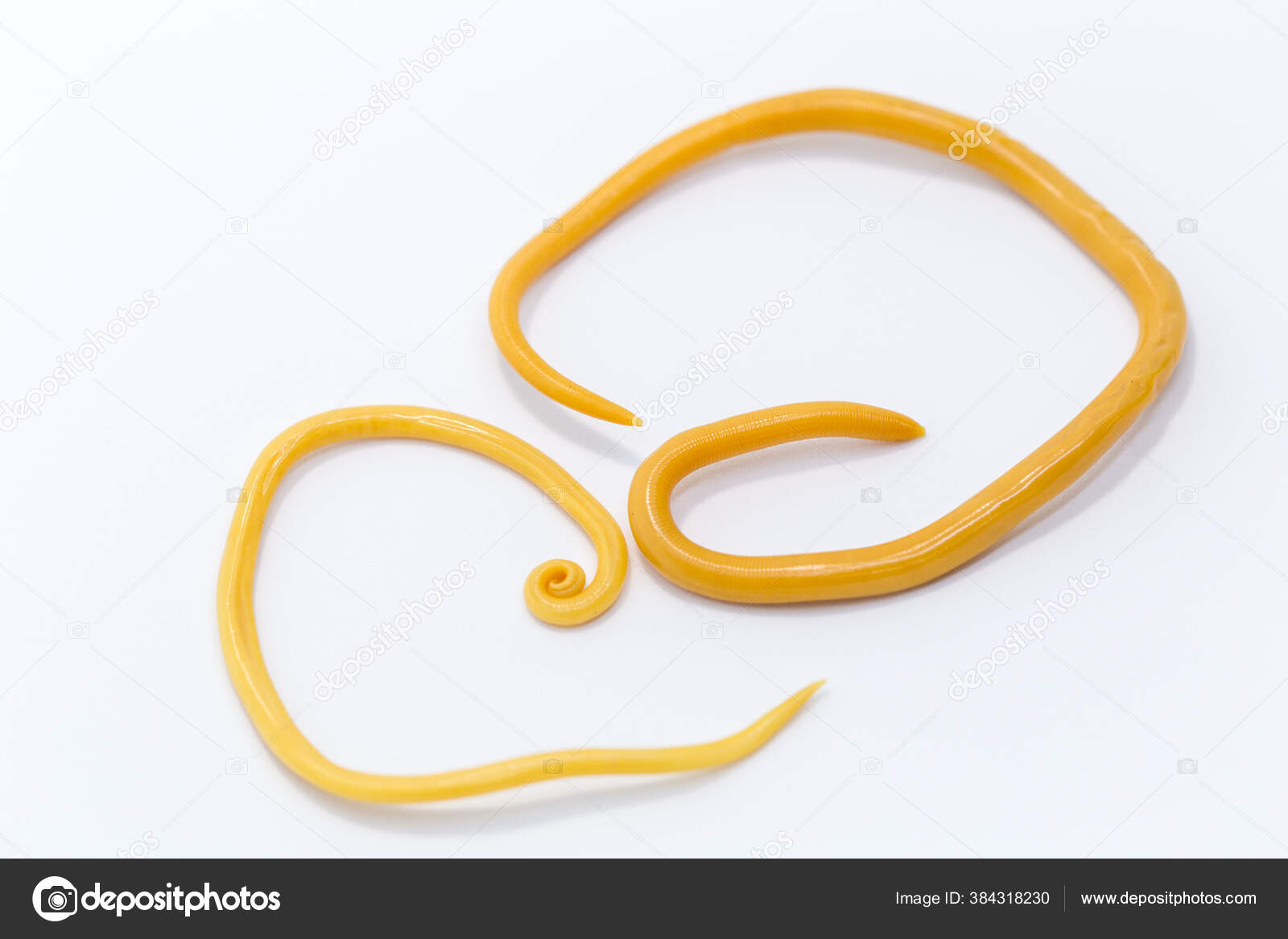 Ascariasis Disease Caused Parasitic Roundworm Ascaris Lumbricoides ...