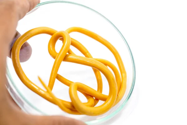 Ascaríase Uma Doença Causada Pelo Parasita Lombricoides Ascaris Para ...