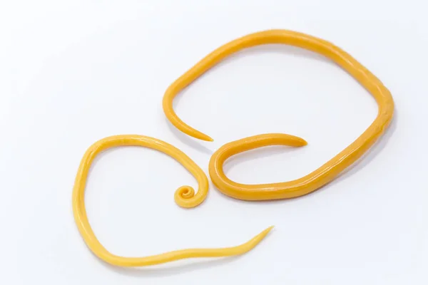 Ascariasis Stock Photos, Royalty Free Ascariasis Images | Depositphotos