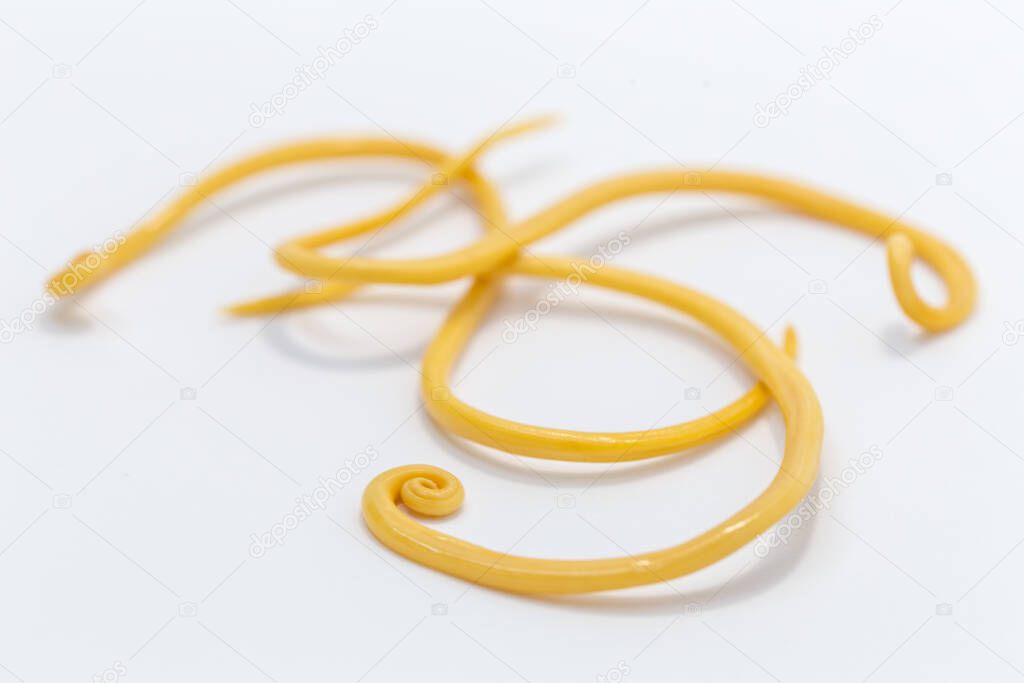 La ascariasis es una enfermedad causada por el gusano parásito Ascaris ...