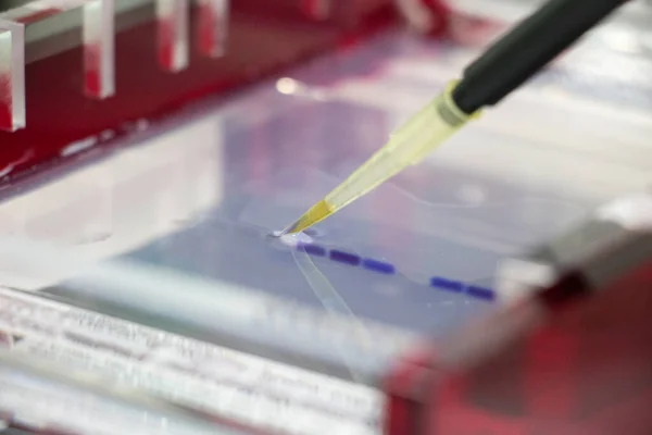 La Reacción En Cadena De La Polimerasa Pcr Y La Electroforesis En Gel