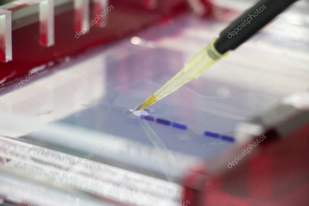 La reacción en cadena de la polimerasa (PCR) y la electroforesis en gel de agarosa es un método ...