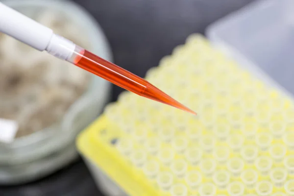 La Reacción En Cadena De La Polimerasa Pcr Y La Electroforesis En Gel