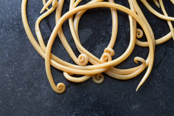 Ascaríase Uma Doença Causada Pelo Parasita Lombricoides Ascaris Para ...