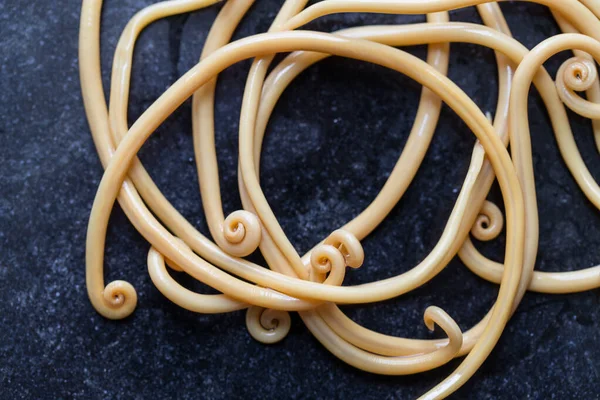 Ascaríase Uma Doença Causada Pelo Parasita Lombricoides Ascaris Para ...