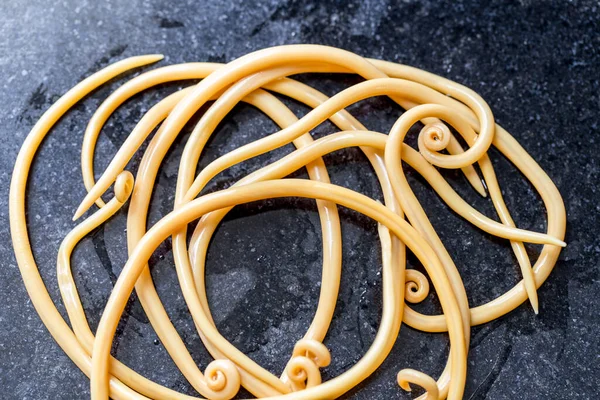 Ascaríase Uma Doença Causada Pelo Parasita Lombricoides Ascaris Para ...