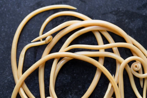 Ascaríase Uma Doença Causada Pelo Parasita Lombricoides Ascaris Para ...