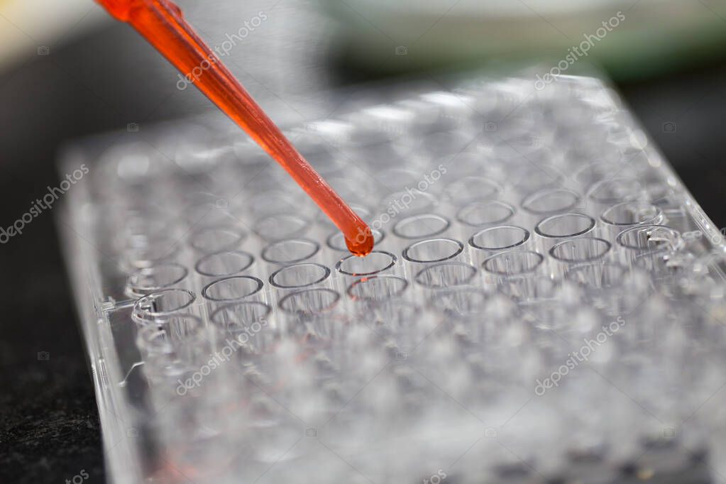 La Reacción En Cadena De La Polimerasa Pcr Y La Electroforesis En Gel
