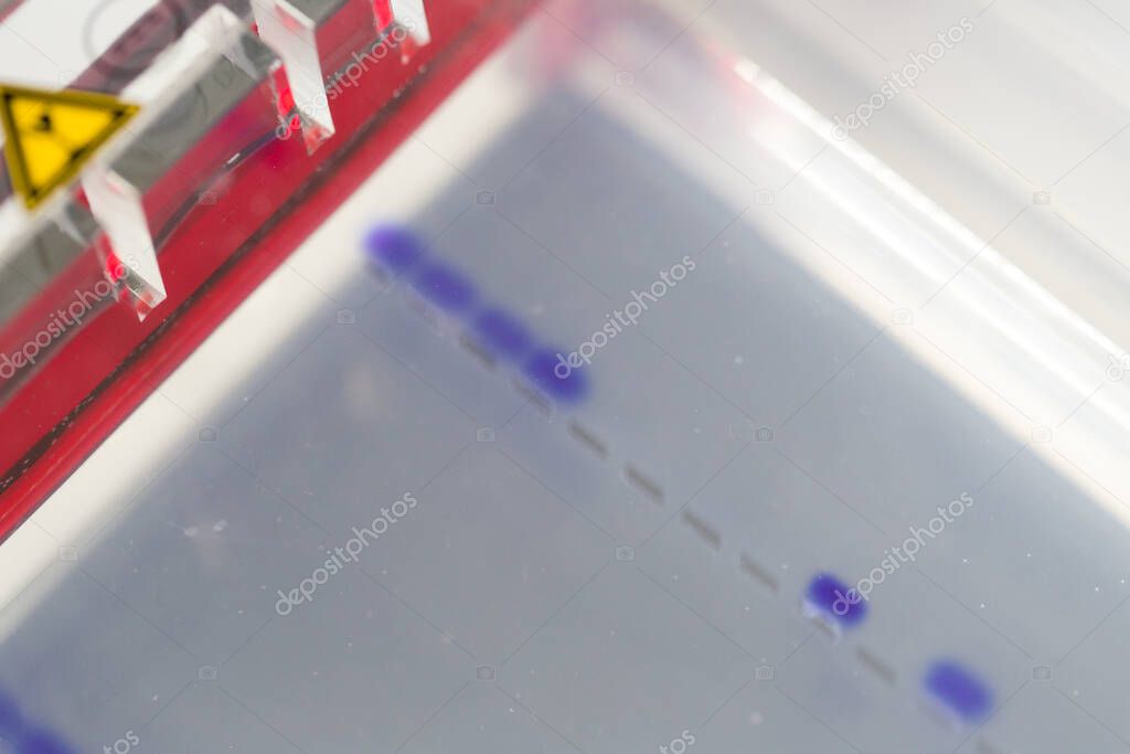 La electroforesis en gel de agarosa es un método de electroforesis en ...