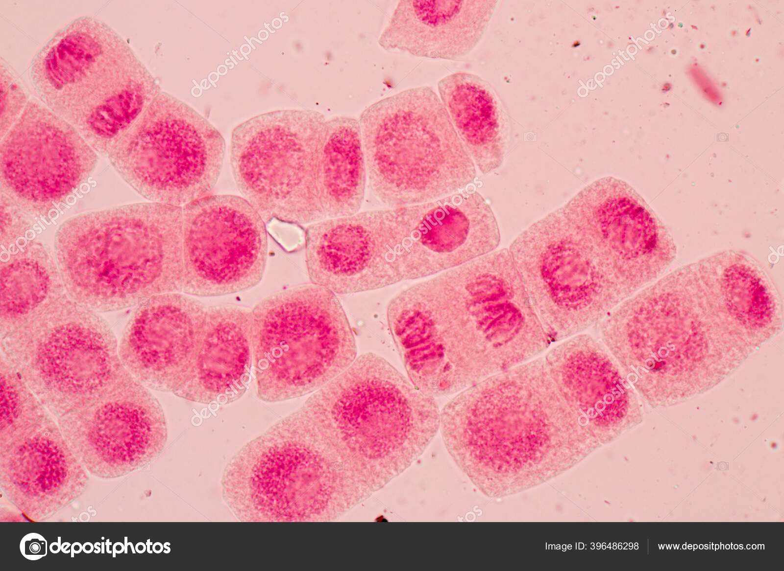 Fases De Mitosis Punta De La Raíz De Cebolla Mitosis En Raíz De