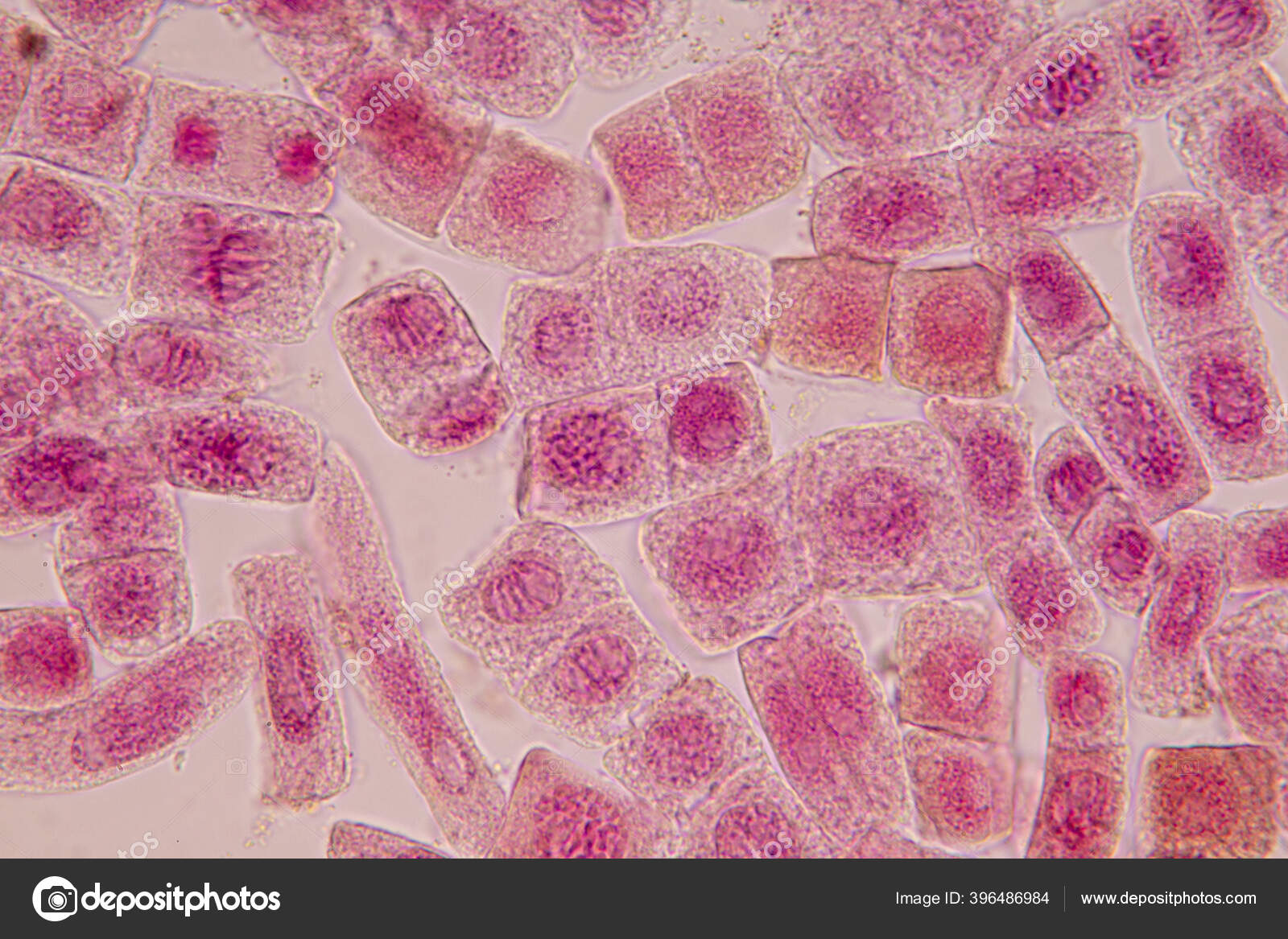Mitosis Phases Onion Root Tip