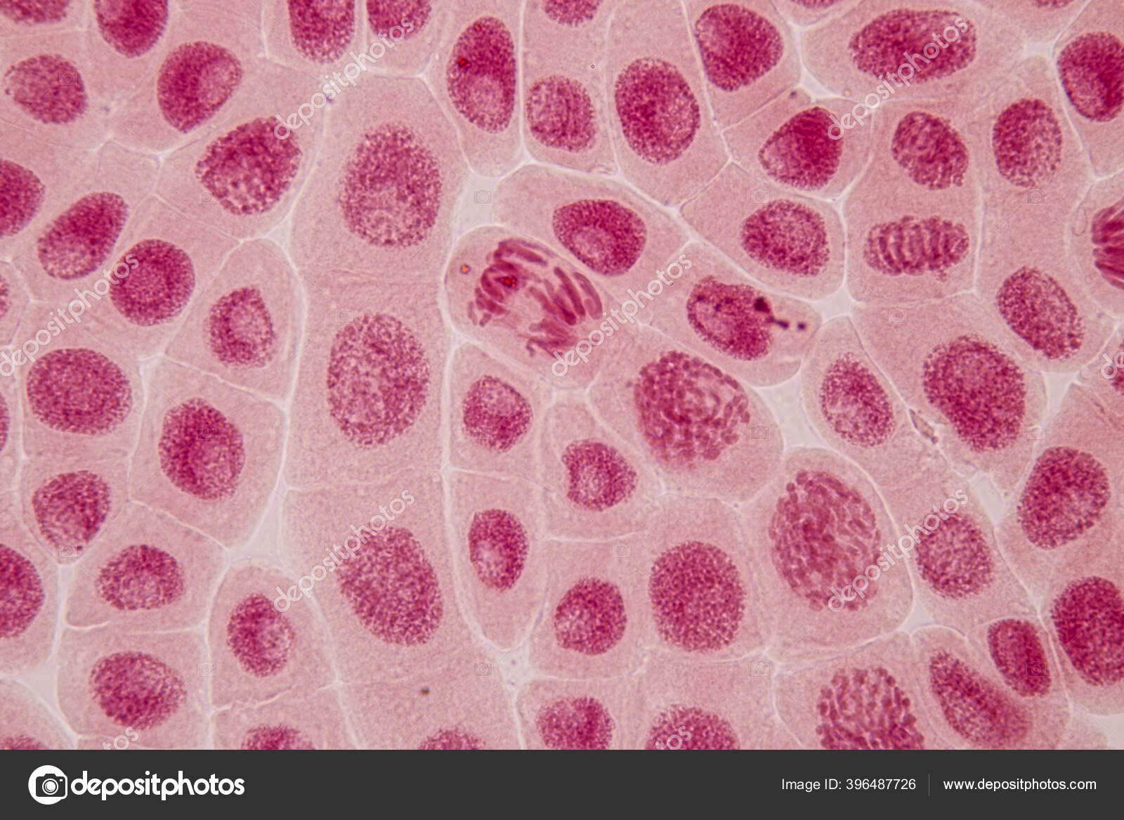 Mitosis Prophase Microscope