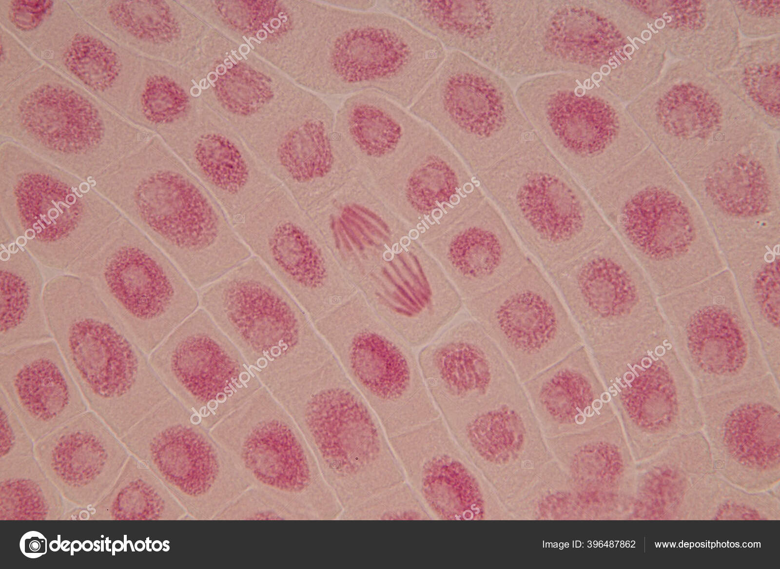 Root Tip Onion Mitosis Cell Root Tip Onion Microscope Stock ...