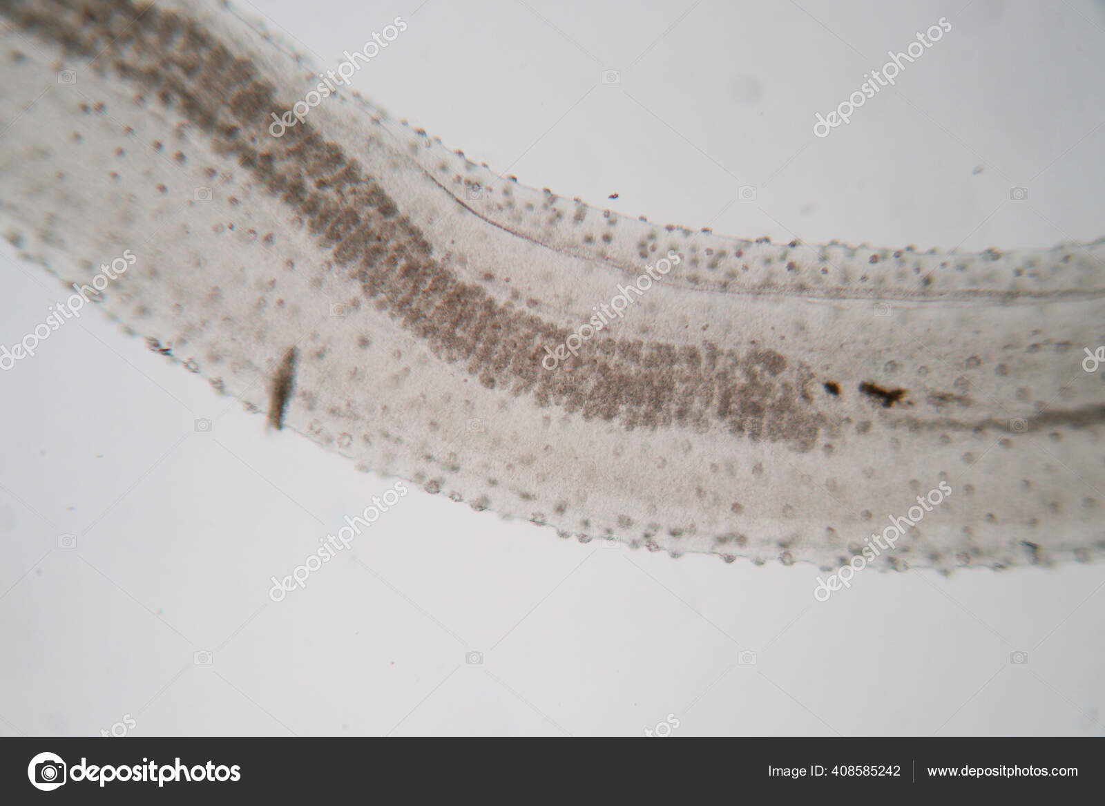 Study Parasite Worms Freshwater Fish Parasite Laboratory Education ...