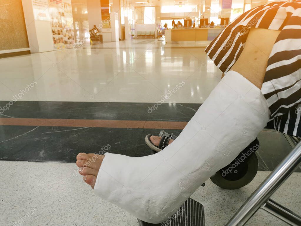 Acercar a una mujer con una pierna rota sentarse en una silla de ruedas ...