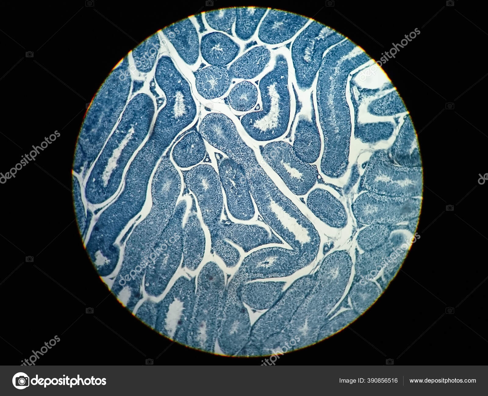 Cross Section Human Testis Microscope View Shows Spermatogonia ...