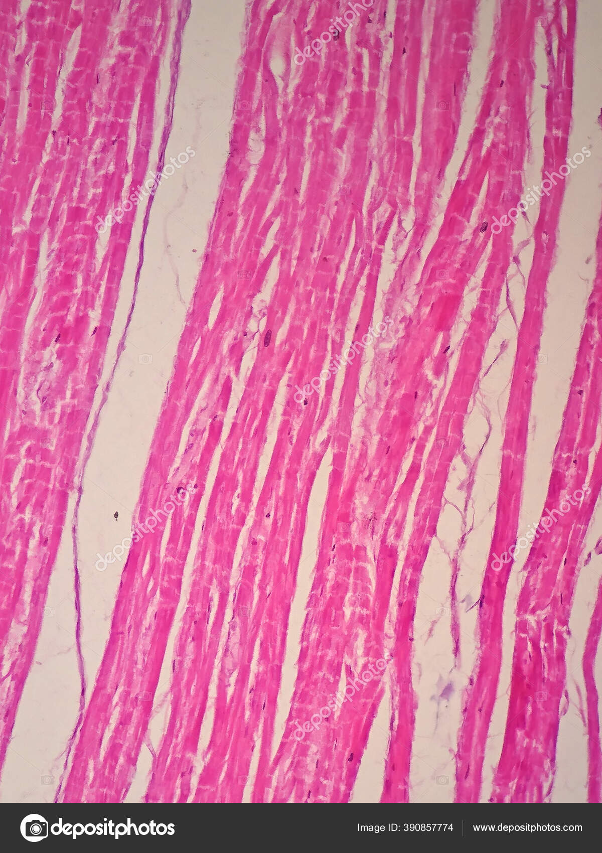 Histology Cardiac Muscle Microscope View — Stock Photo © tonaquatic19 ...