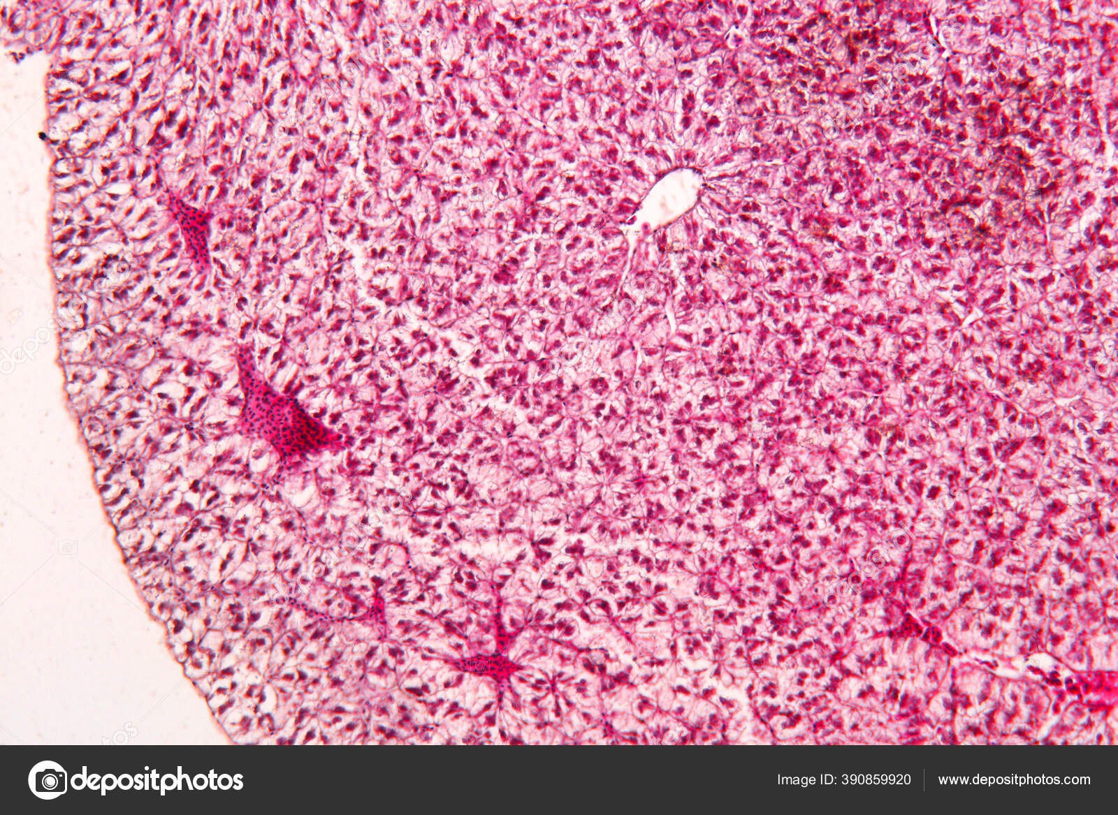 Hígado Tejido Animal Bajo Vista Del Microscopio Histología Del Hígado ...