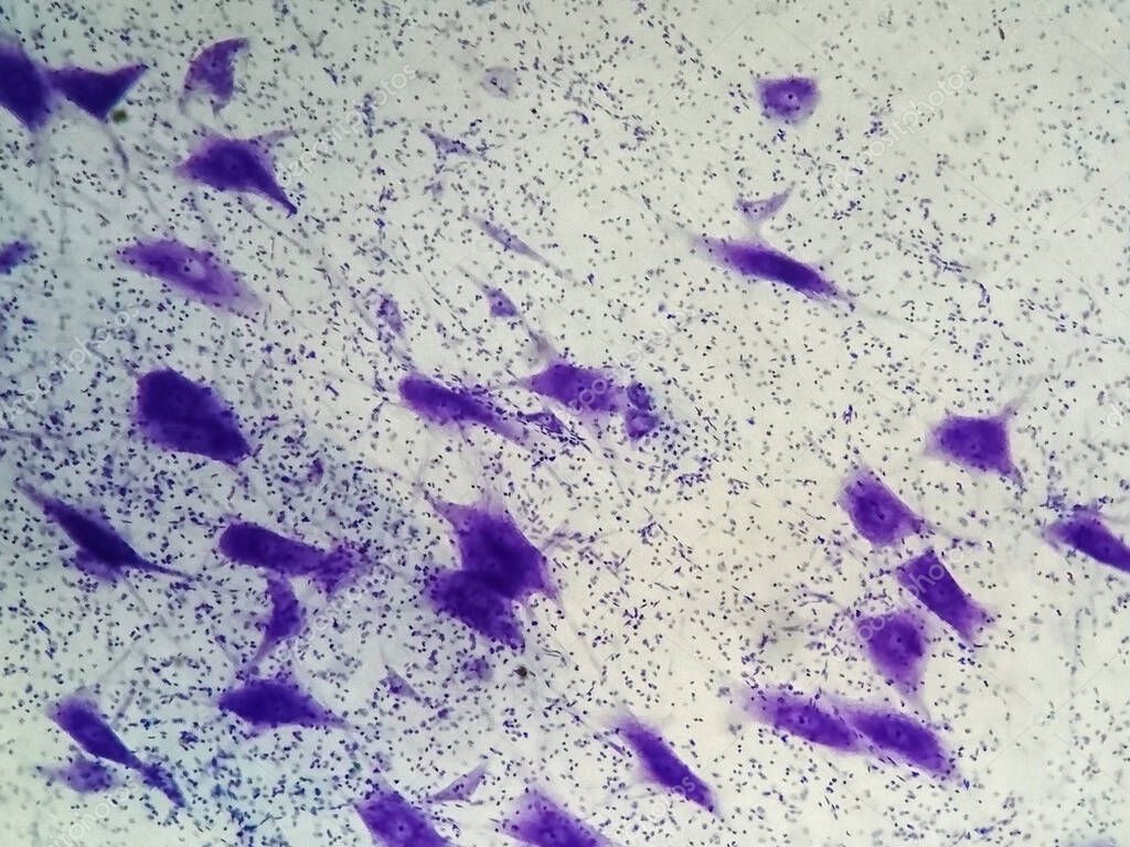 Neuronas células del cerebro bajo el microscopio ver 2022