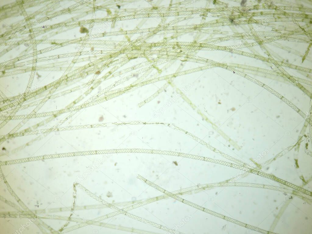 Las algas filamentosas son células de algas individuales que forman ...