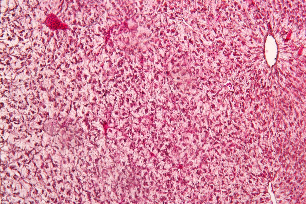 Hígado tejido animal bajo la vista del microscopio, Histología del ...
