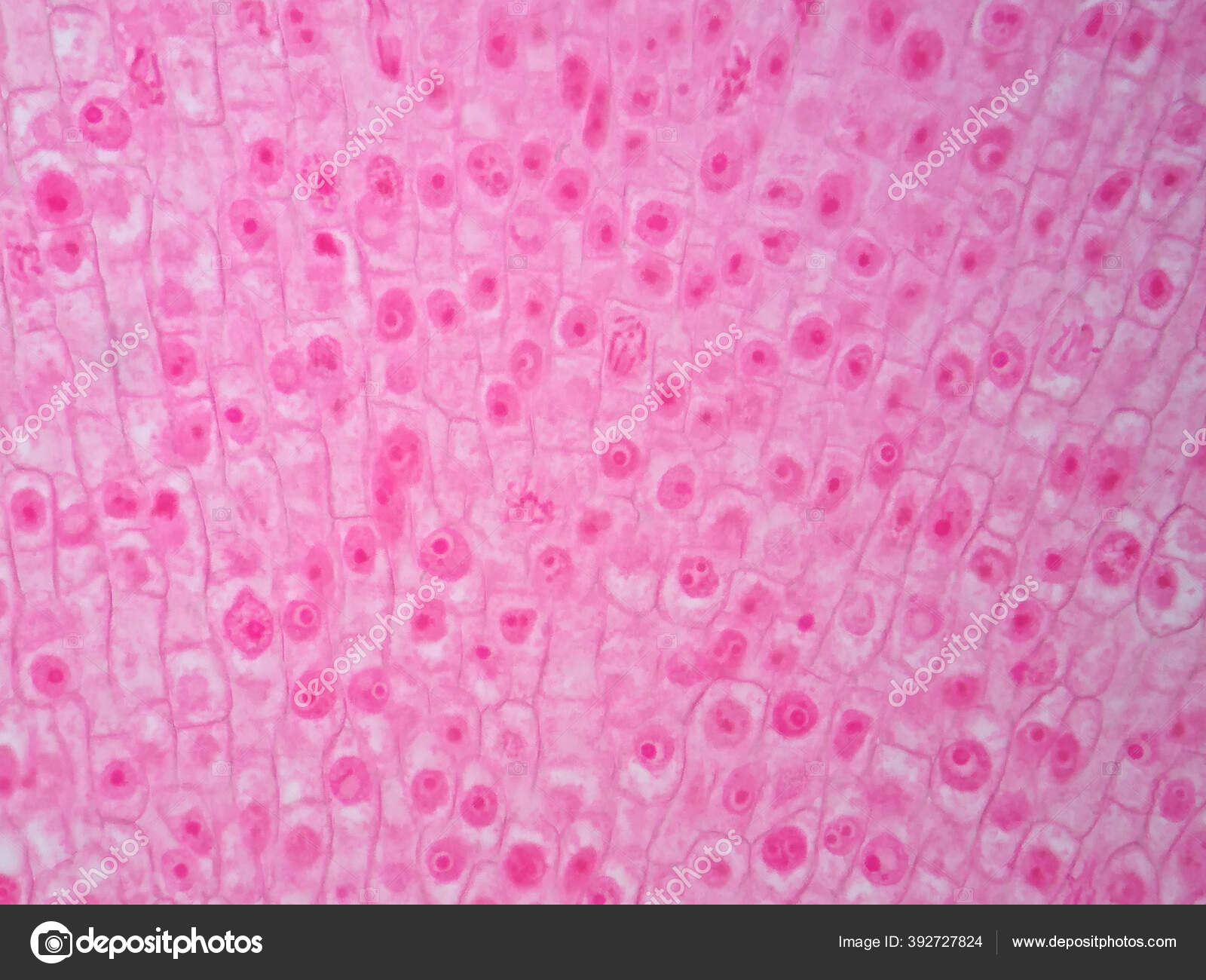 Cross Sections Plant Root Microscope View Tissue Show Actively Dividing ...