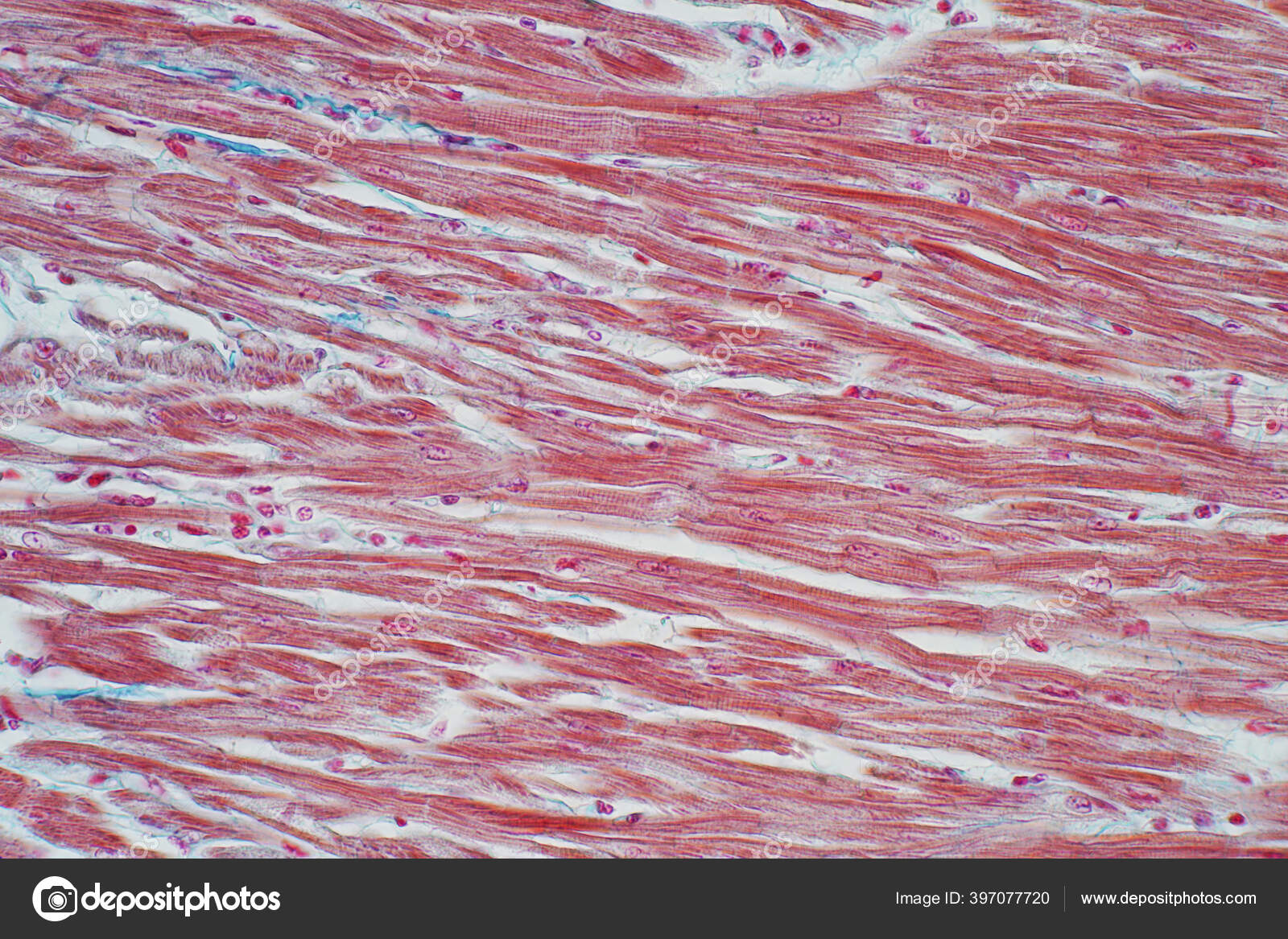 Histology Human Cardiac Muscle Microscope View Education Human Tissue ...