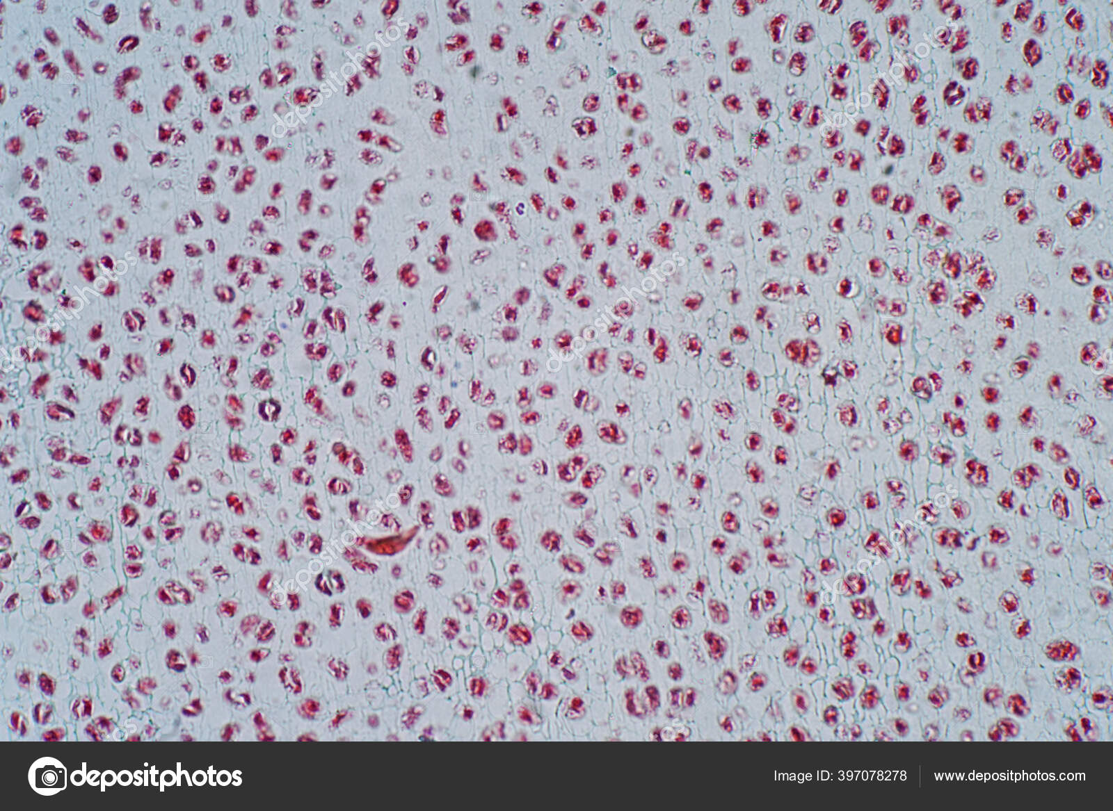Cross Section Human Cartilage Bone Microscope View Education Histology ...
