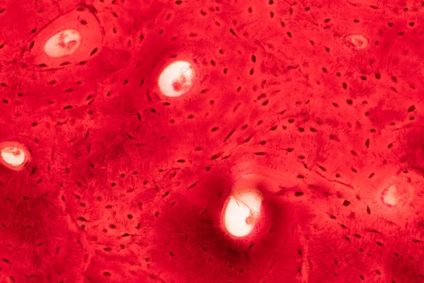 Histology Human Compact Bone Tissue Microscope View Education Muscle ...