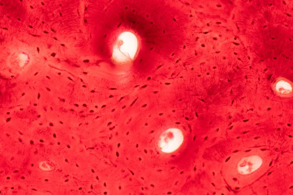 Histology Human Compact Bone Tissue Microscope View Education Muscle ...