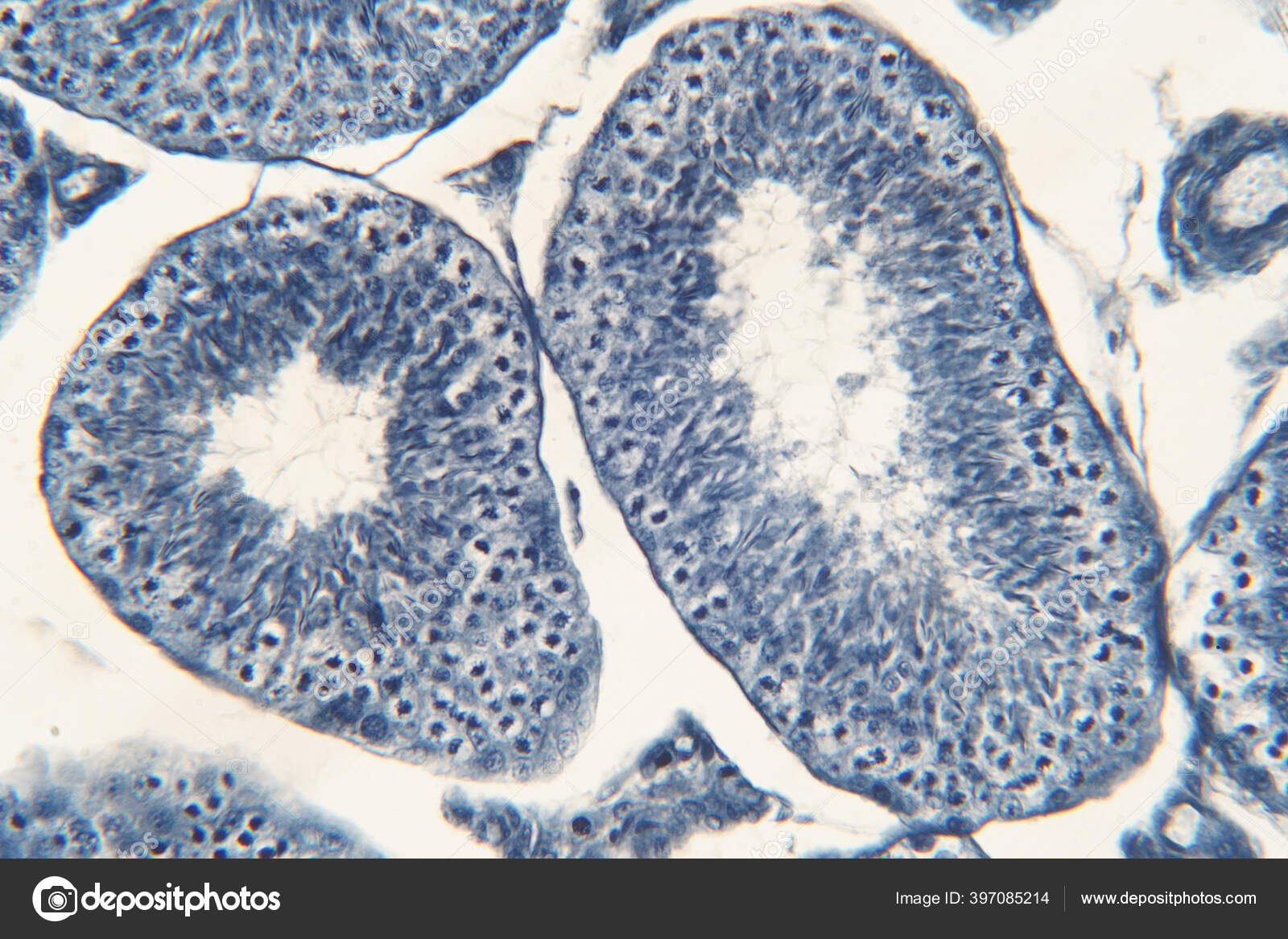 Human Testis Microscope View Shows Spermatogonia Spermatocytes Meiosis ...
