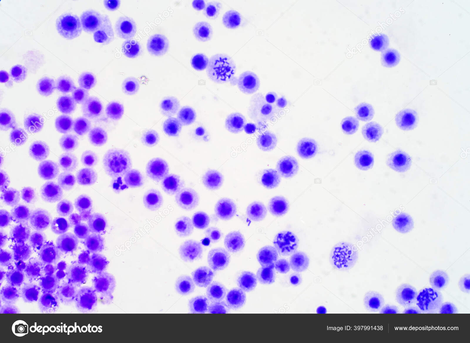 Human Chromosomes Microscope View Education Stock Photo by ...