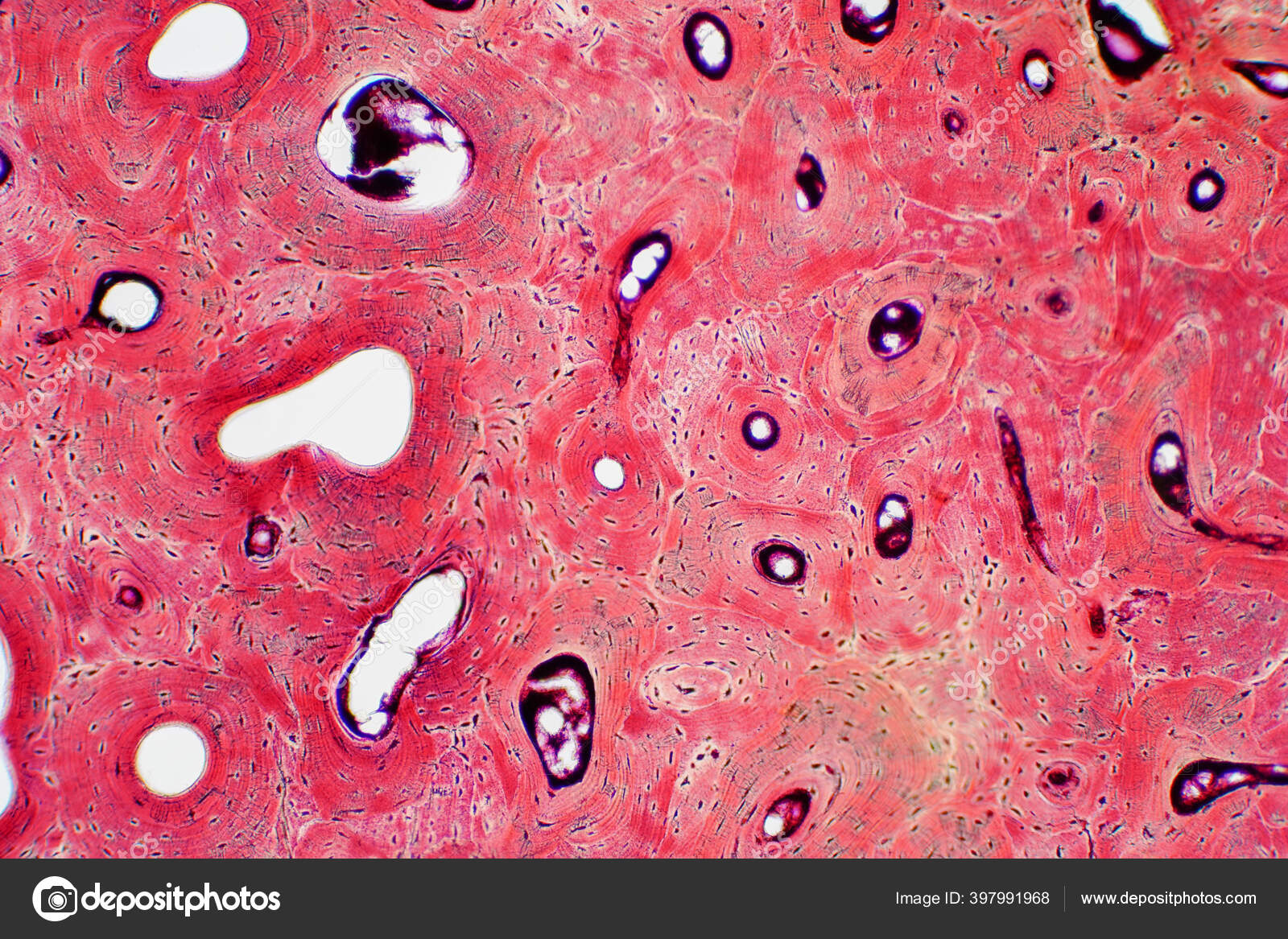 Fibrocartilage Histology