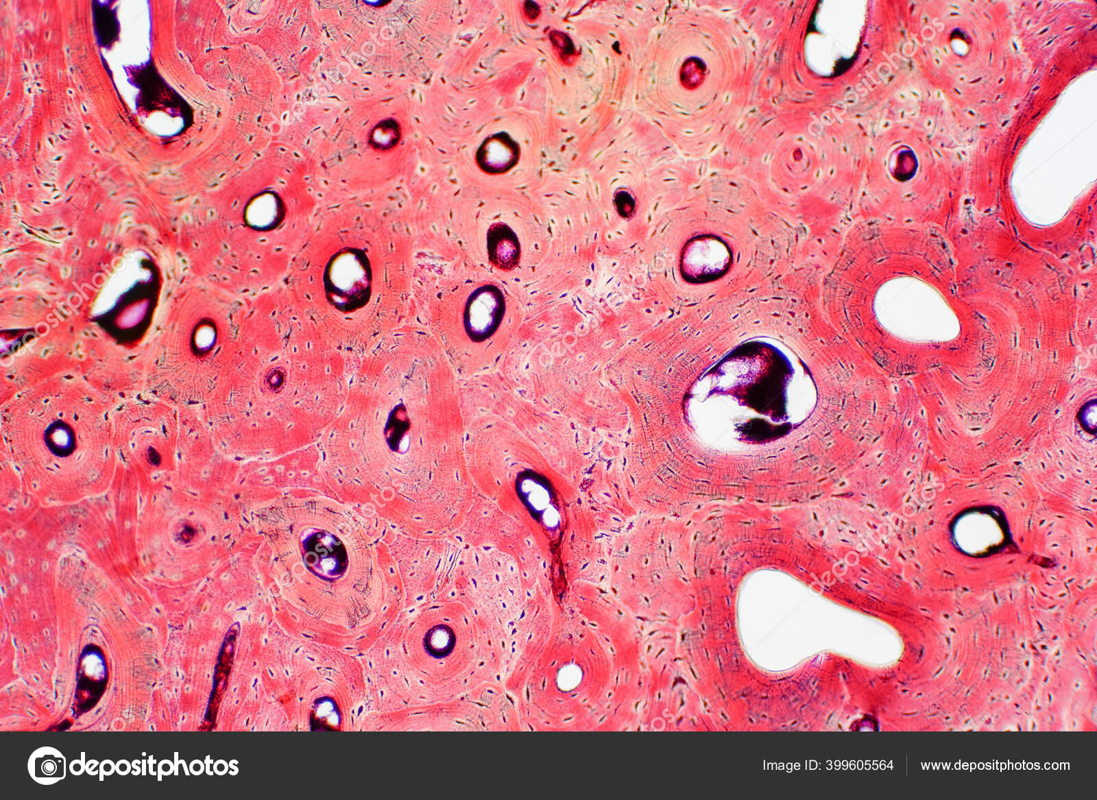 Histologia Tecido Ósseo Compacto Humano Sob Visão Microscópica Para ...
