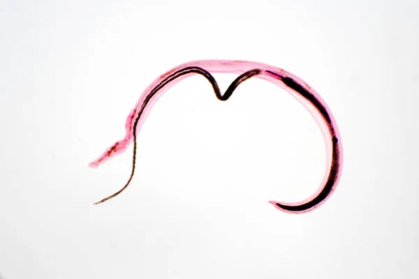 Whipworm Stock Photos, Royalty Free Whipworm Images | Depositphotos