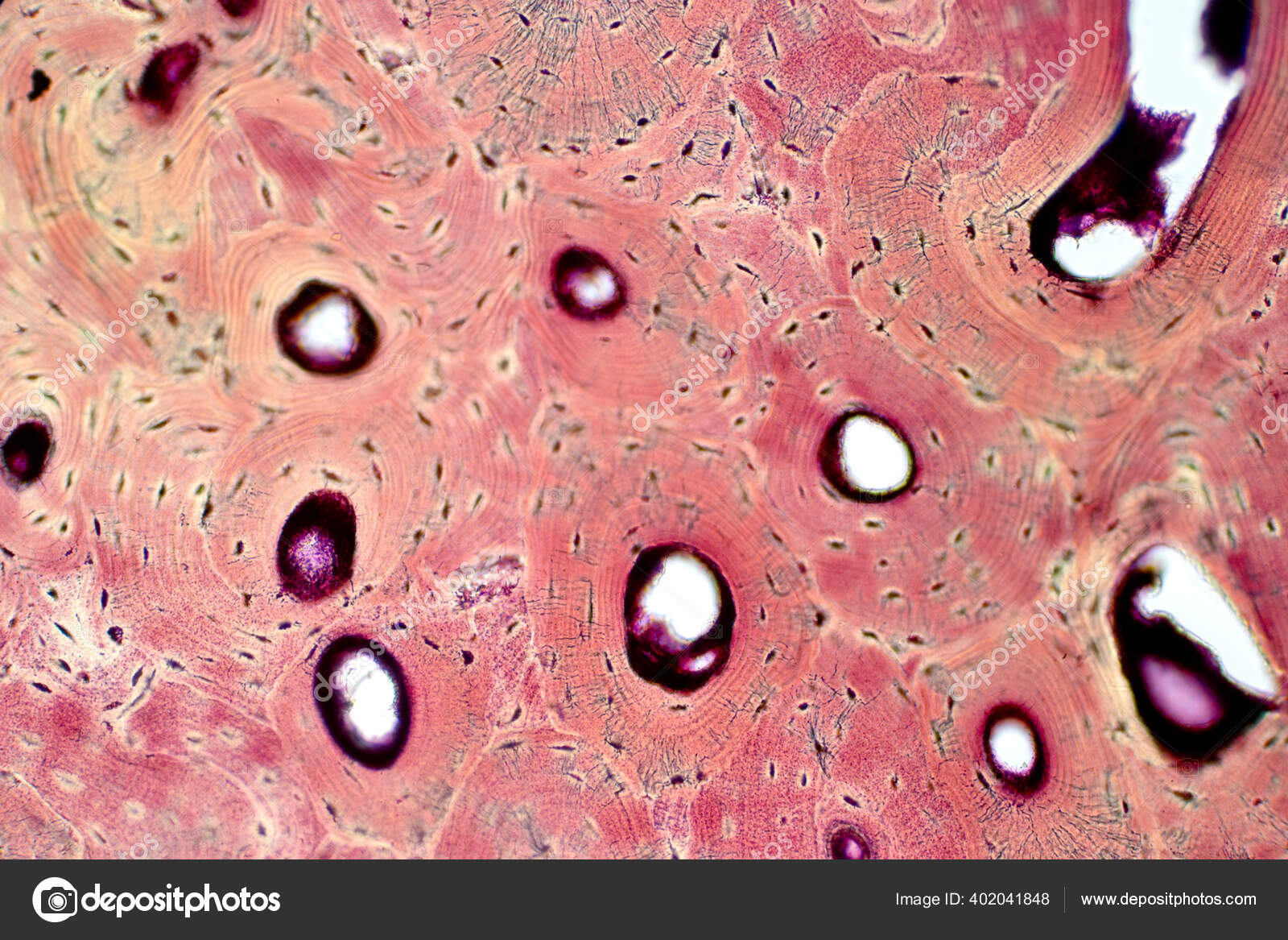 Bone Cell Microscope