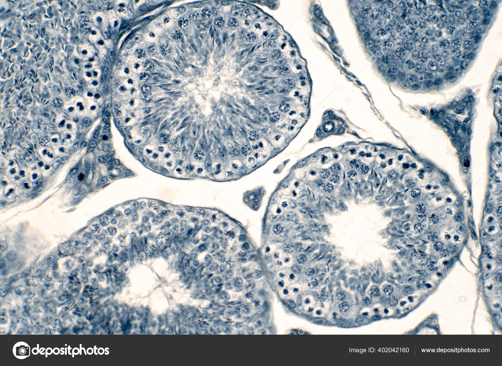 Cross Section Human Testis Microscope View Shows Spermatogonia ...