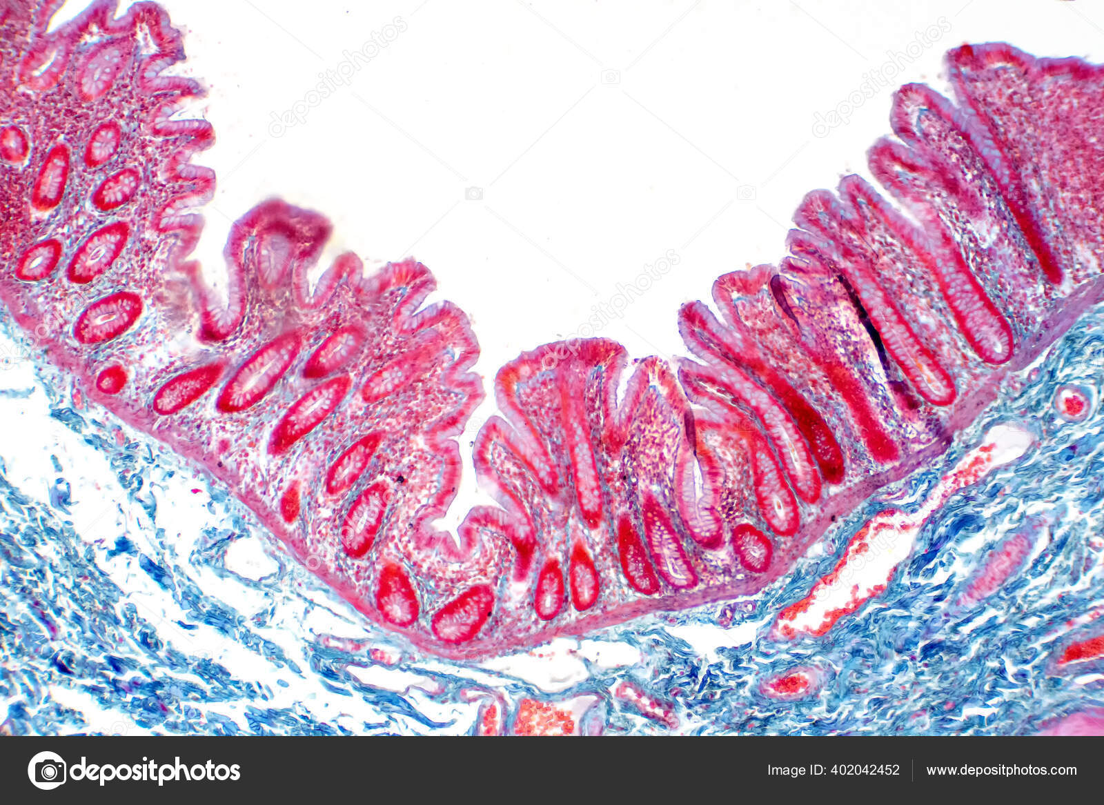 Human Large Intestine Tissue Microscope View Histological Human ...