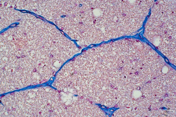 Doorsnede Van Het Ruggenmerg Onder Microscoop Histologisch Voor ...