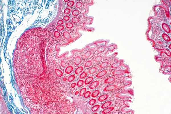 Human large intestine tissue under microscope view. Histological for ...