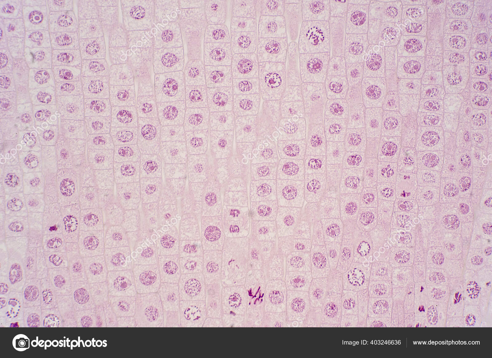 Root Tip Onion Show Mitosis Cell Root Tip Microscope View — Stock Photo ...
