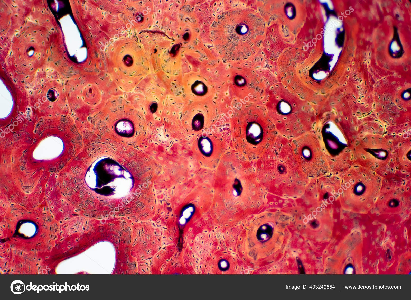 Bone Cell Under Microscope