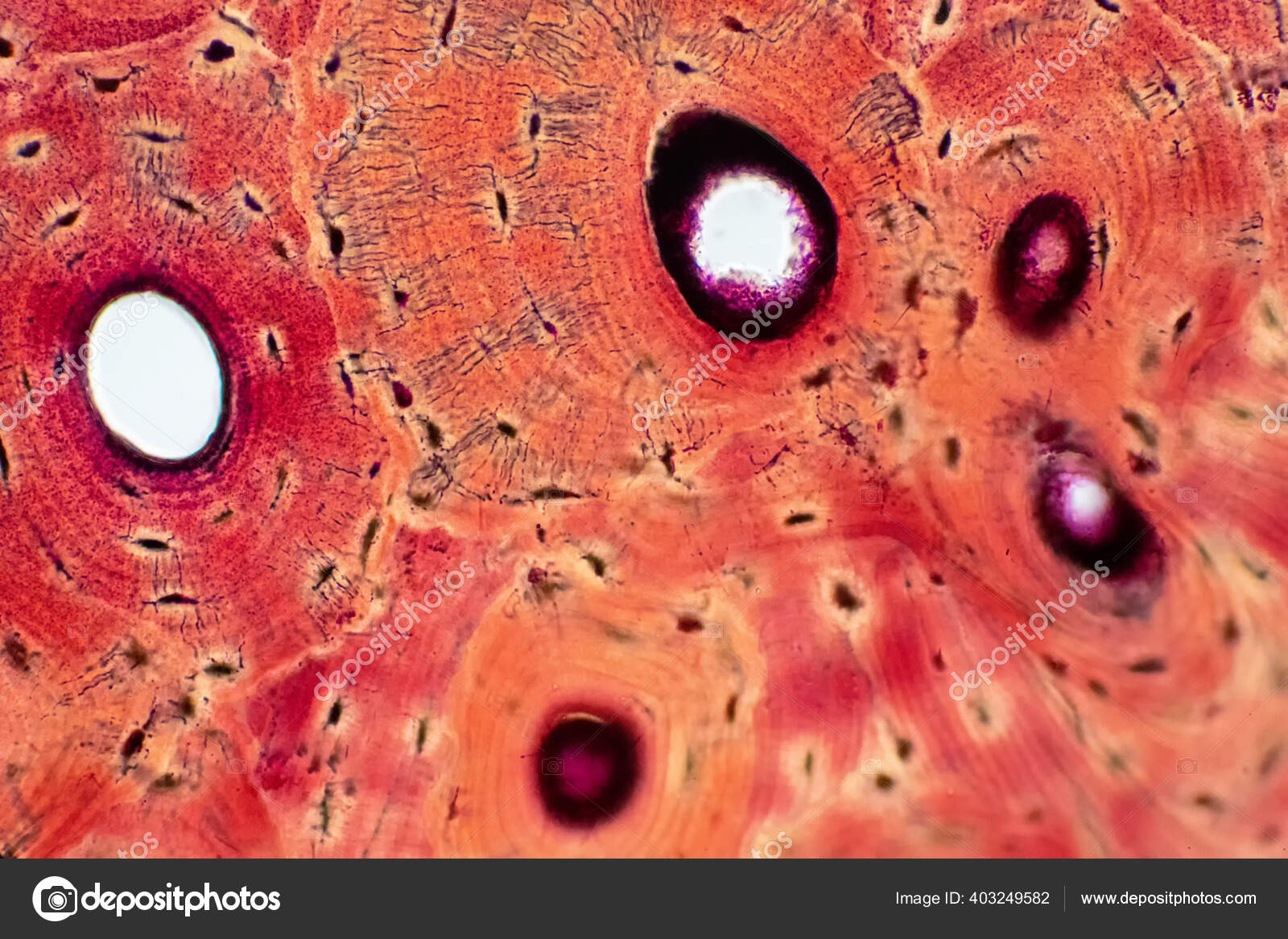 Bone Cells Under A Microscope