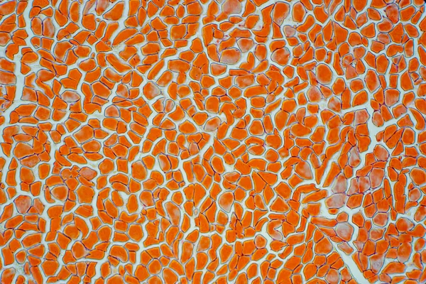 Cross section muscle skeleton micro preparation samples- section ...