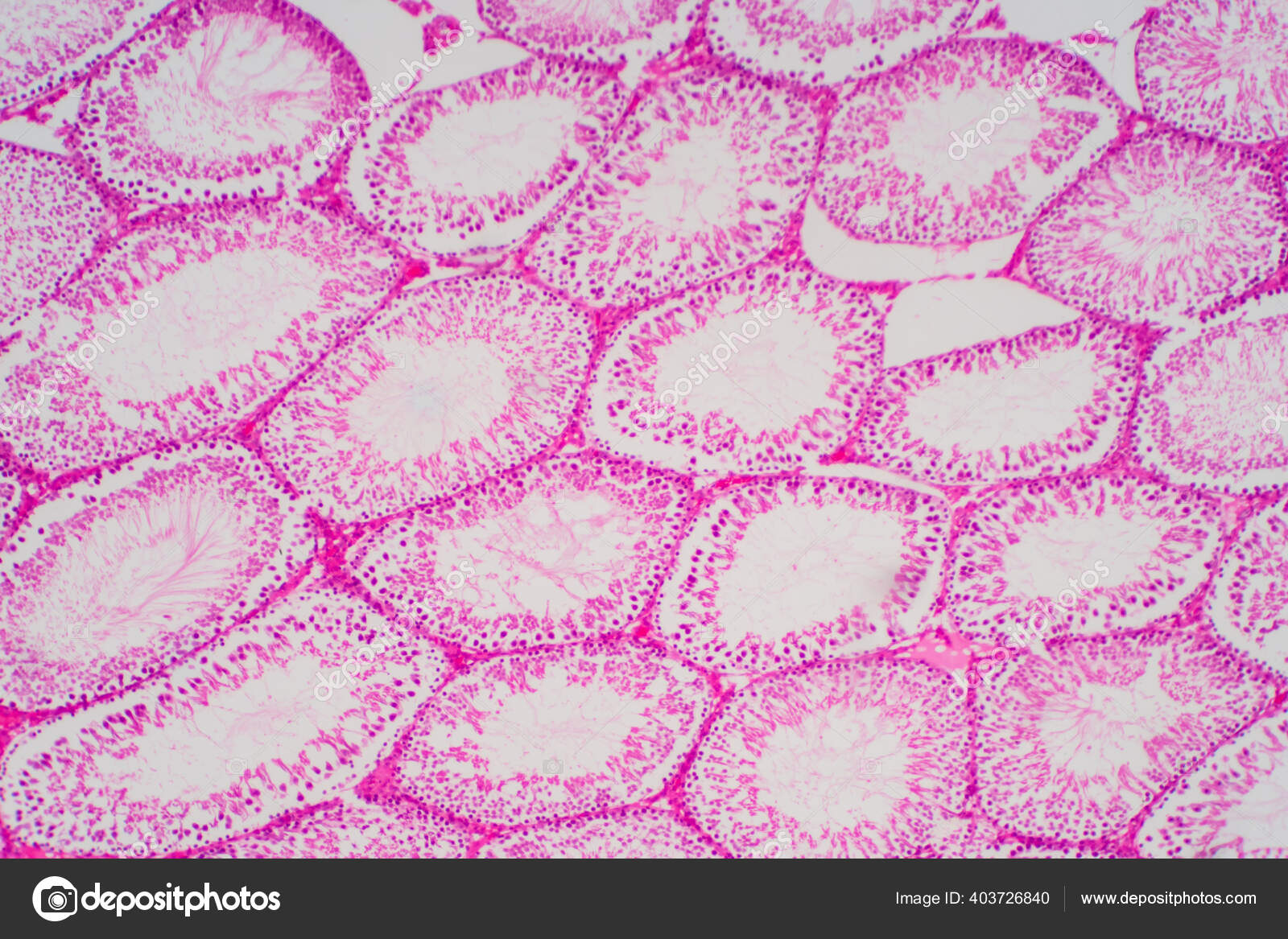 Testis Cross Section With Sperm
