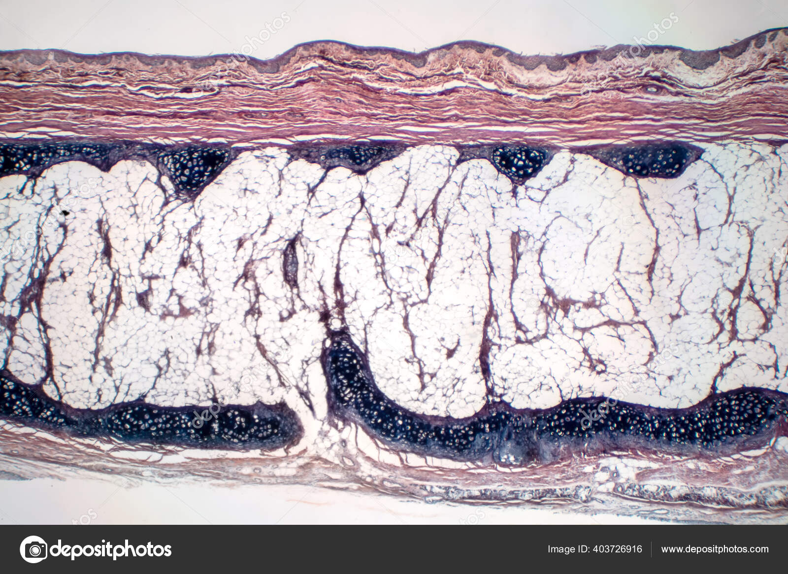 Human Hyaline Cartilage Bone Microscope View Education Pathology Human ...