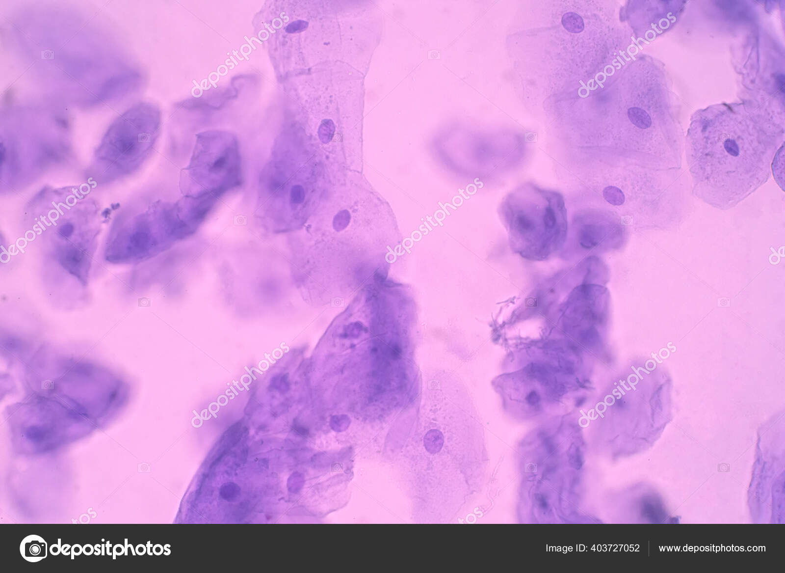 Cheek Epithelial Cells