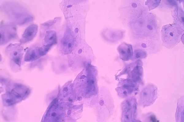 Human Cheek Epithelial Cells Tissue Lines Mouth Known Basal Mucosa ...